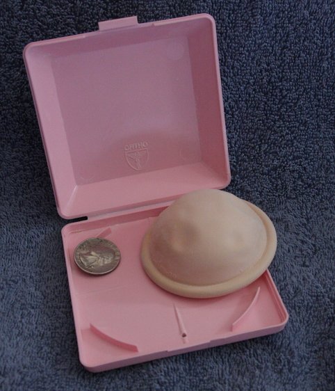 Contraception - general overview | Patient